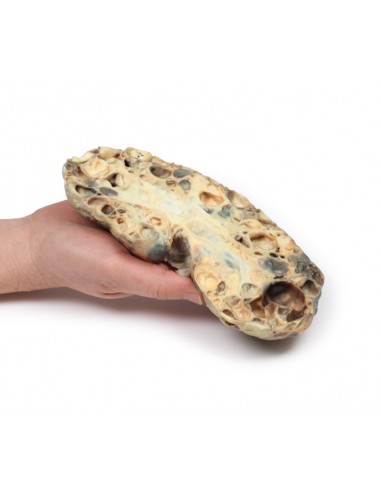 Malattia del rene policistico dell adulto Erler Zimmer 3D anatomy Series